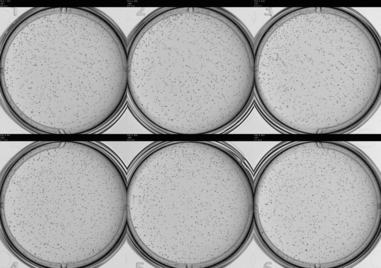 Re Evaluating Manual Colony Counting How Automated Counting Is Saving