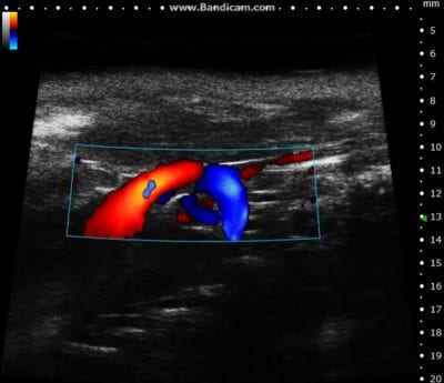 High Frequency Ultrasound | Animal Ultrasound | Preclinical