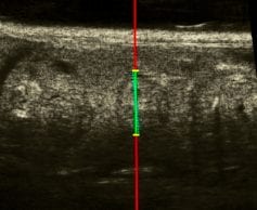 mouse embryo heart m-mode sample volume - Scintica