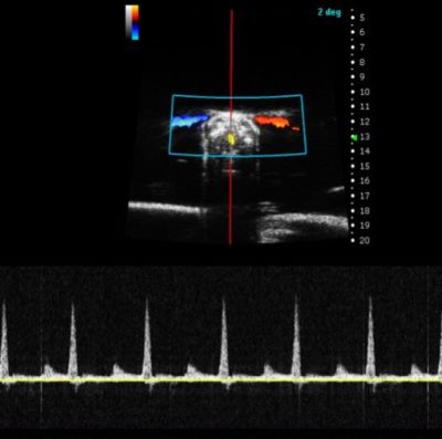 High Frequency Ultrasound | Animal Ultrasound | Preclinical
