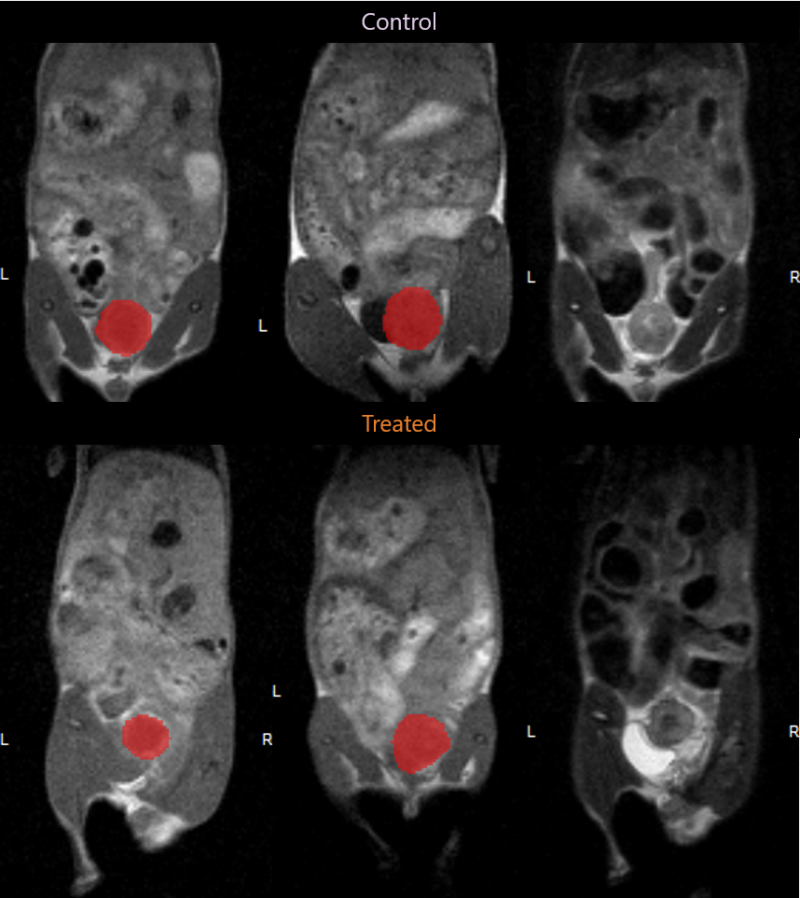 Cancer Biology and Magnetic Resonance Imaging (MRI): The Gold Standard ...
