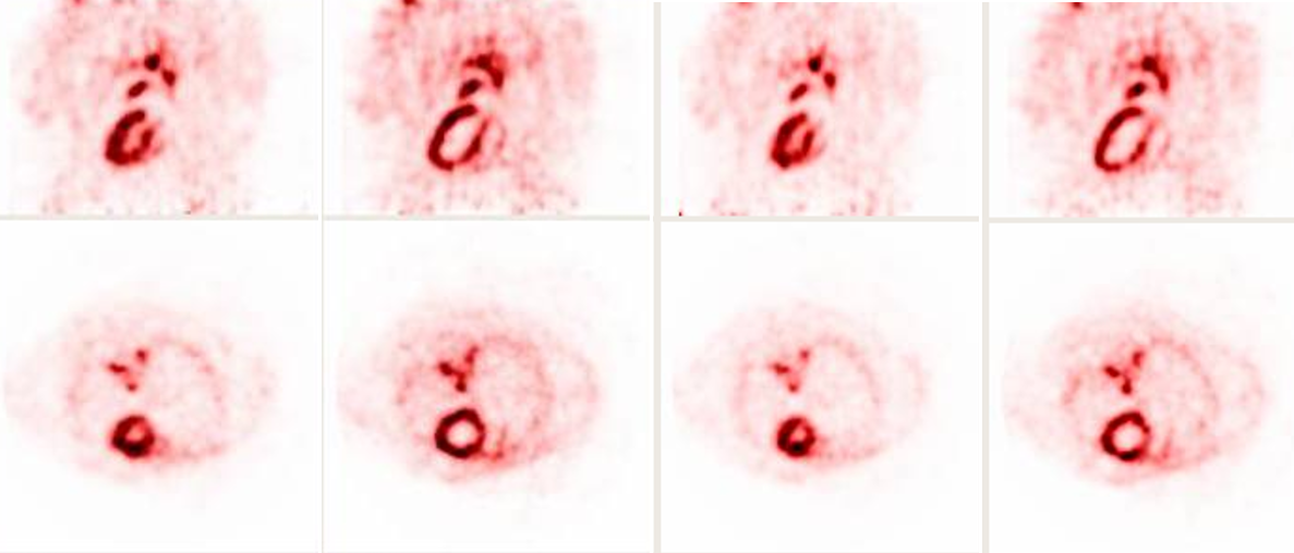 SA - cardiac - Scintica