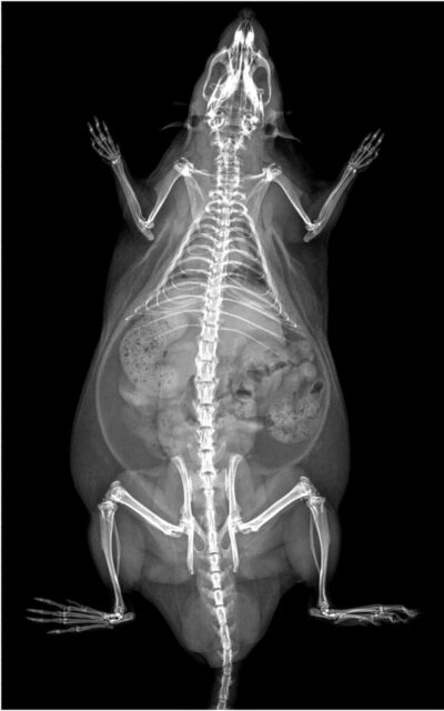 Dual Energy X-Ray Absorptiometry How Does it Work?