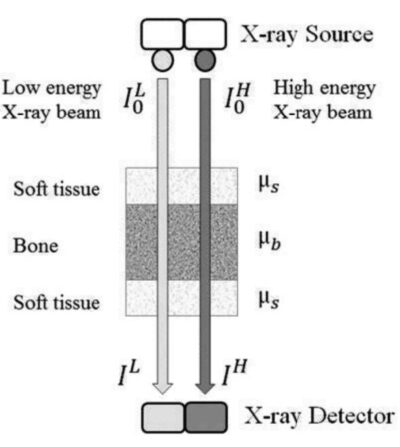 Dual Energy X-Ray Absorptiometry How Does it Work?