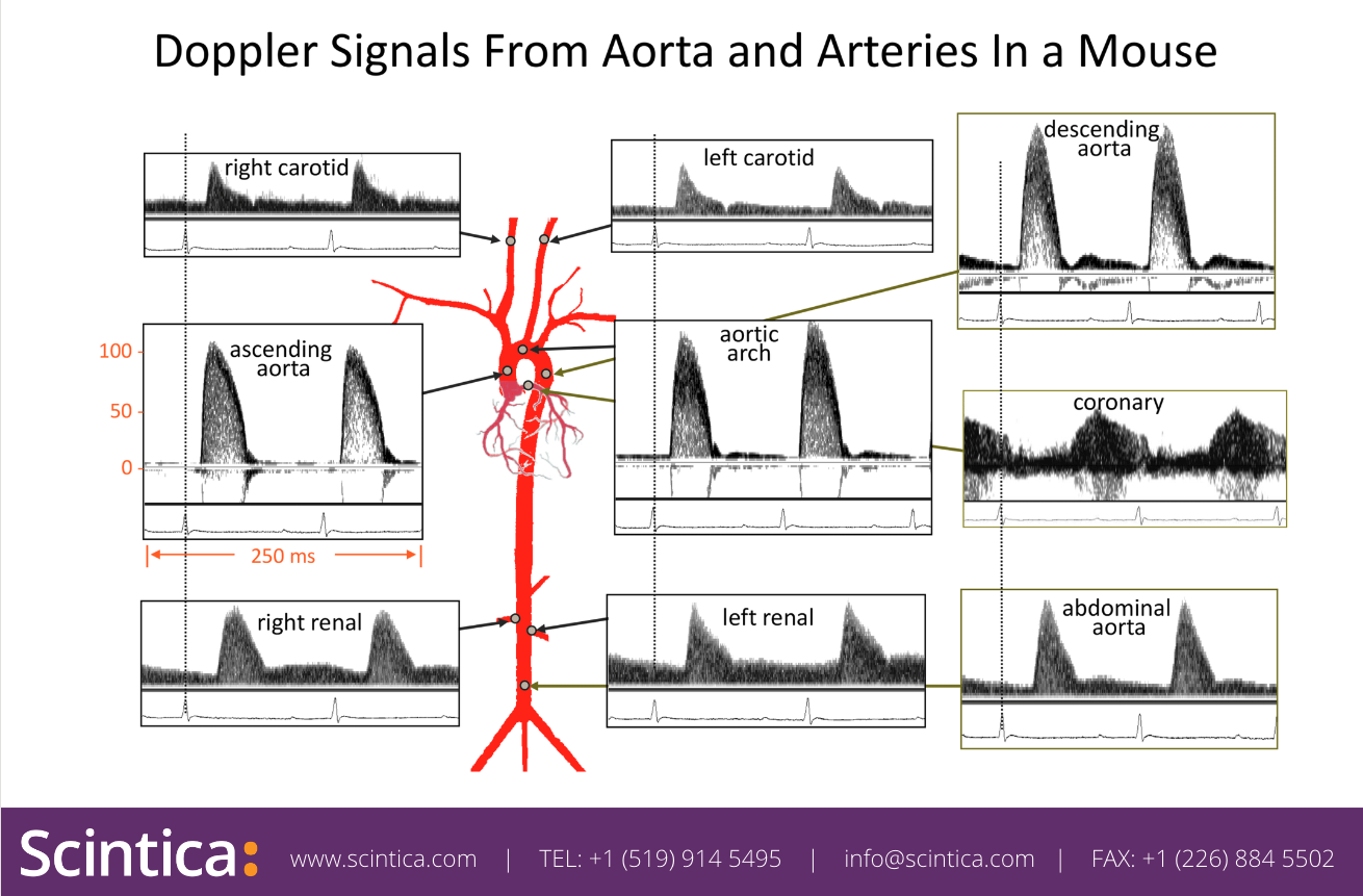 Doppler Signal from Aorta - Scintica