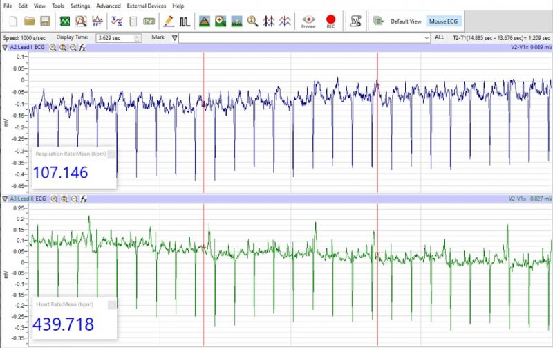 Neonatal Mouse ECG - Scintica