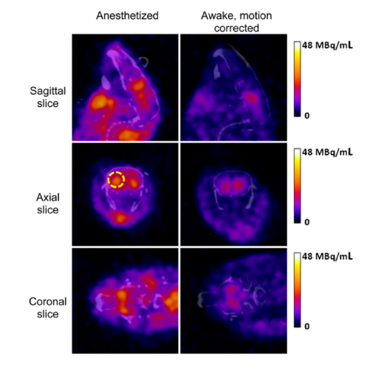 Figure 1 Image Reconstruction Spect Scintica