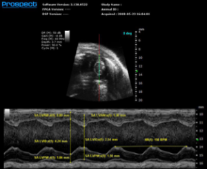M-Mode with Measurements of Systolic Function in the Short Axis of the ...
