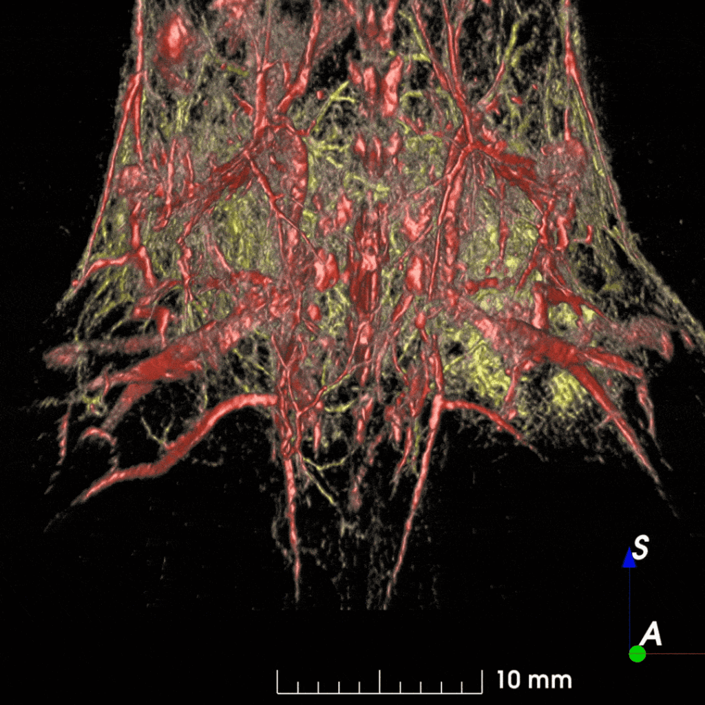 PhotoAcoustic - TRITOM