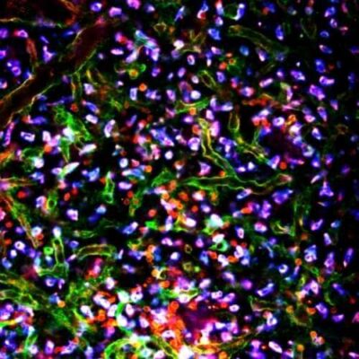 Intravital Microscopy | Confocal Microscopy | Live Animal Imaging