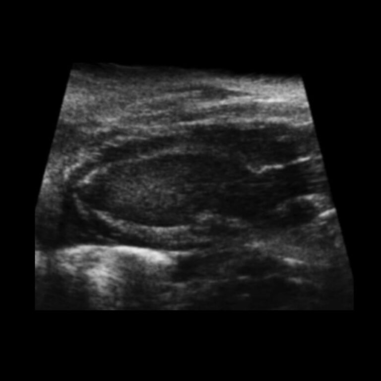 High Frequency Ultrasound | Animal Ultrasound | Preclinical