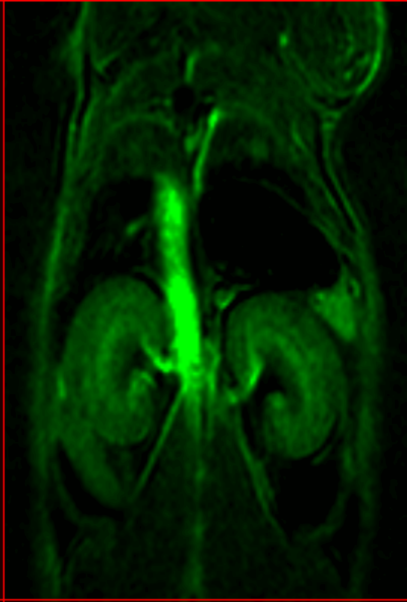Compact MRI | Preclinical MRI | Imaging Technologies