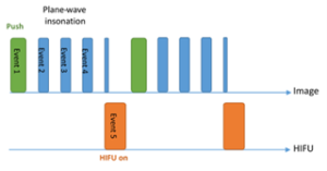 Ultrasound System | Engineering Research | Imaging Systems