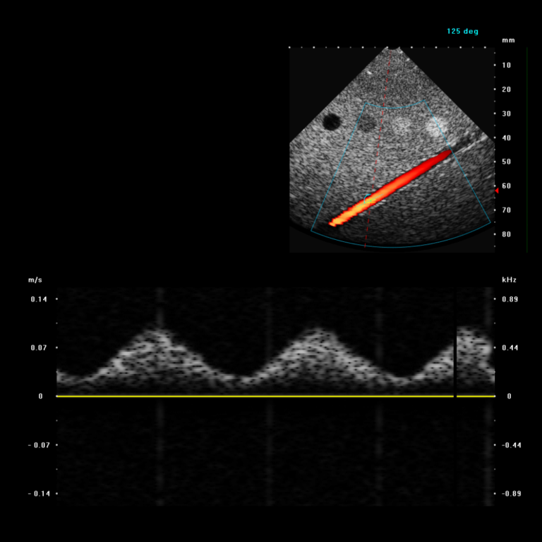 Pulsed-wave (PW) Doppler mode - Scintica