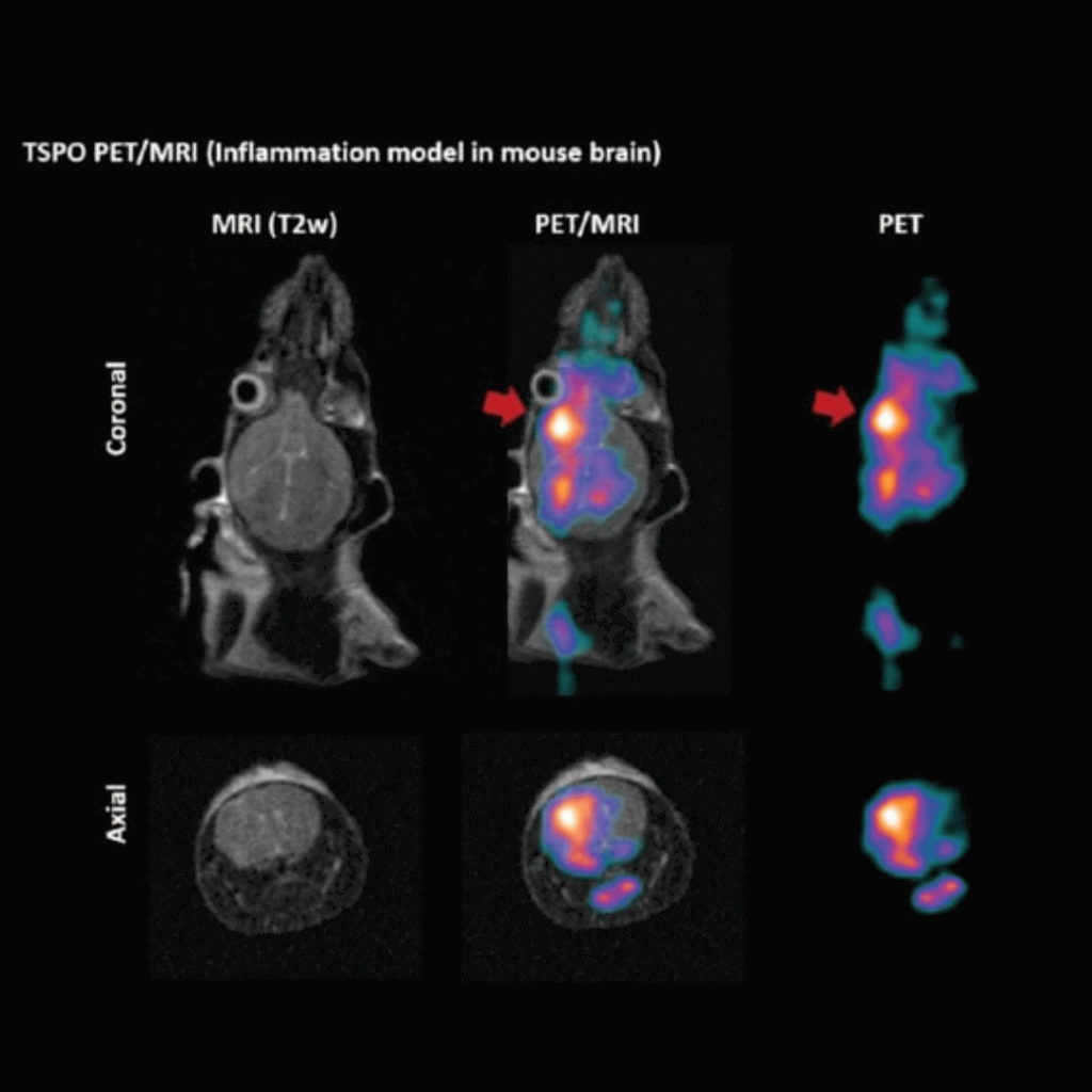 PET MR System | Imaging Technology | PET Imaging