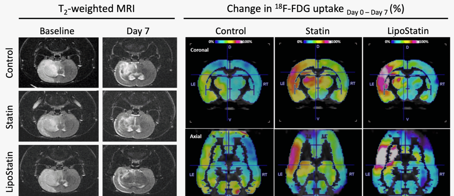 Treatment of Ischemic Stroke by Atorvastatin-loaded PEG