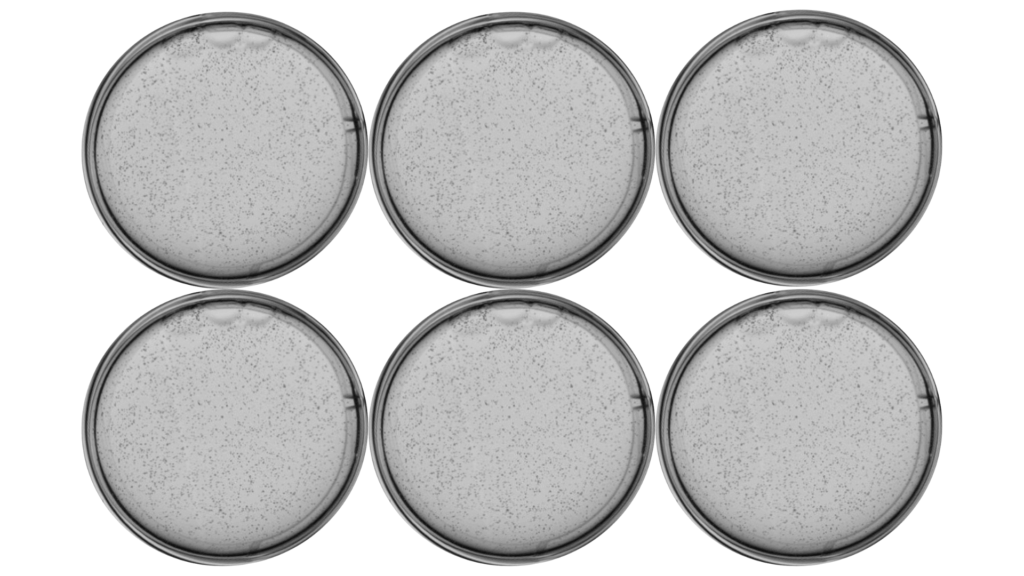 Automated Colony Counter | Gel Count | Cancer Research