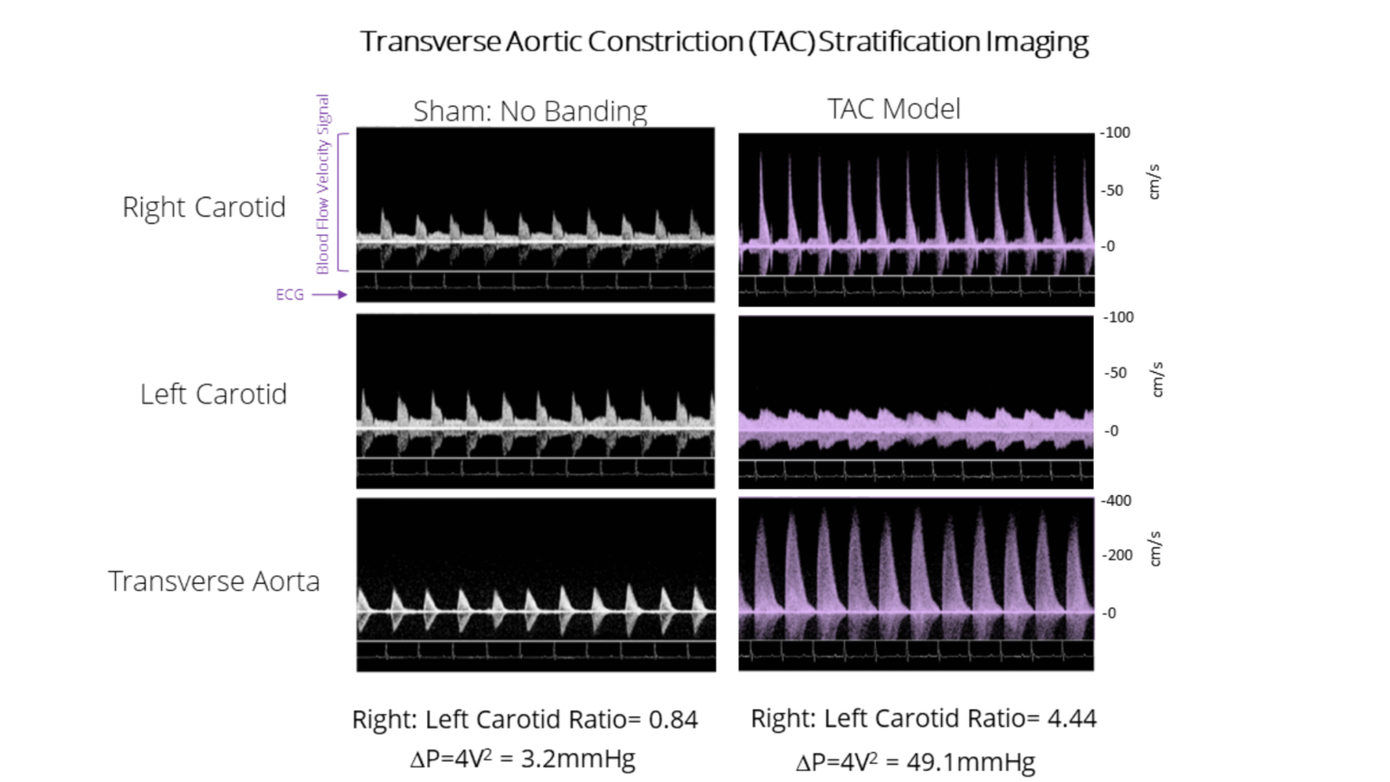 Transverse Aortic Constriction (TAC) Stratification Imaging - Scintica