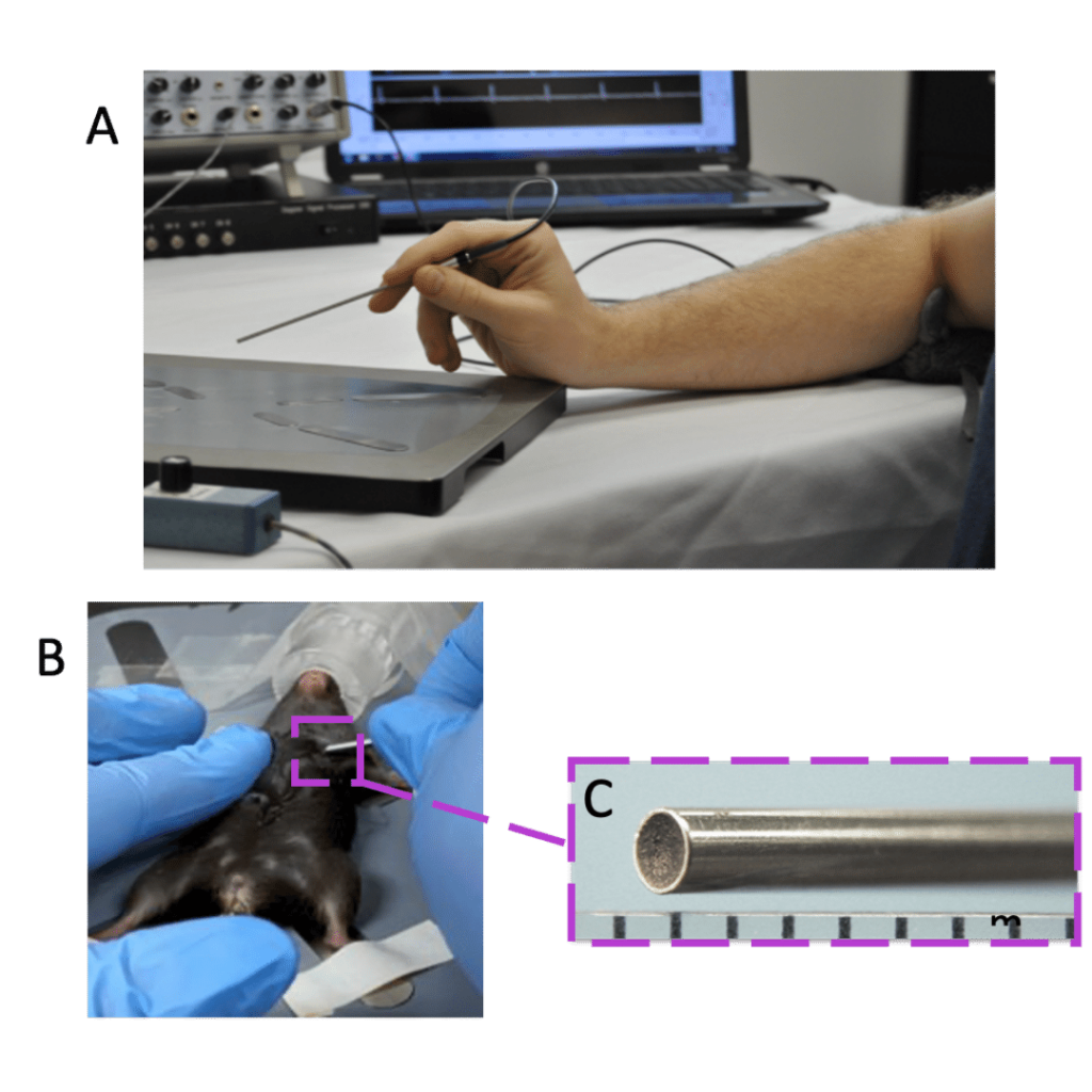 Measuring Coronary Flow Reserve