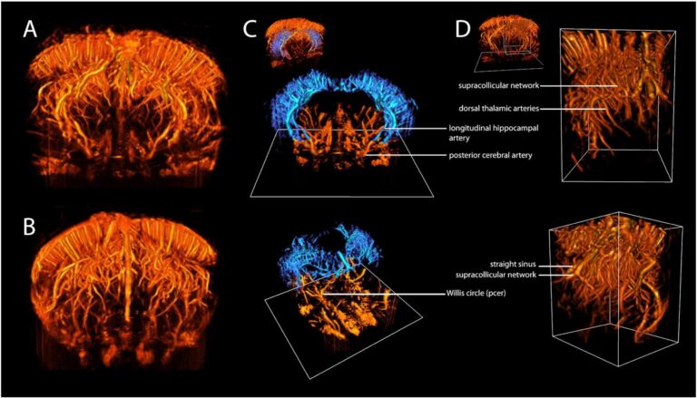 Iconeus One: Functional Ultrasound platform for high-resolution imaging ...